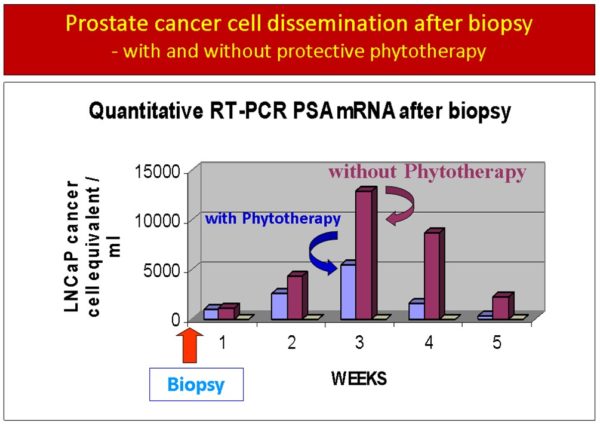Risks and Benefits of Needle Biopsy in Prostate Cancer Diagnosis ...